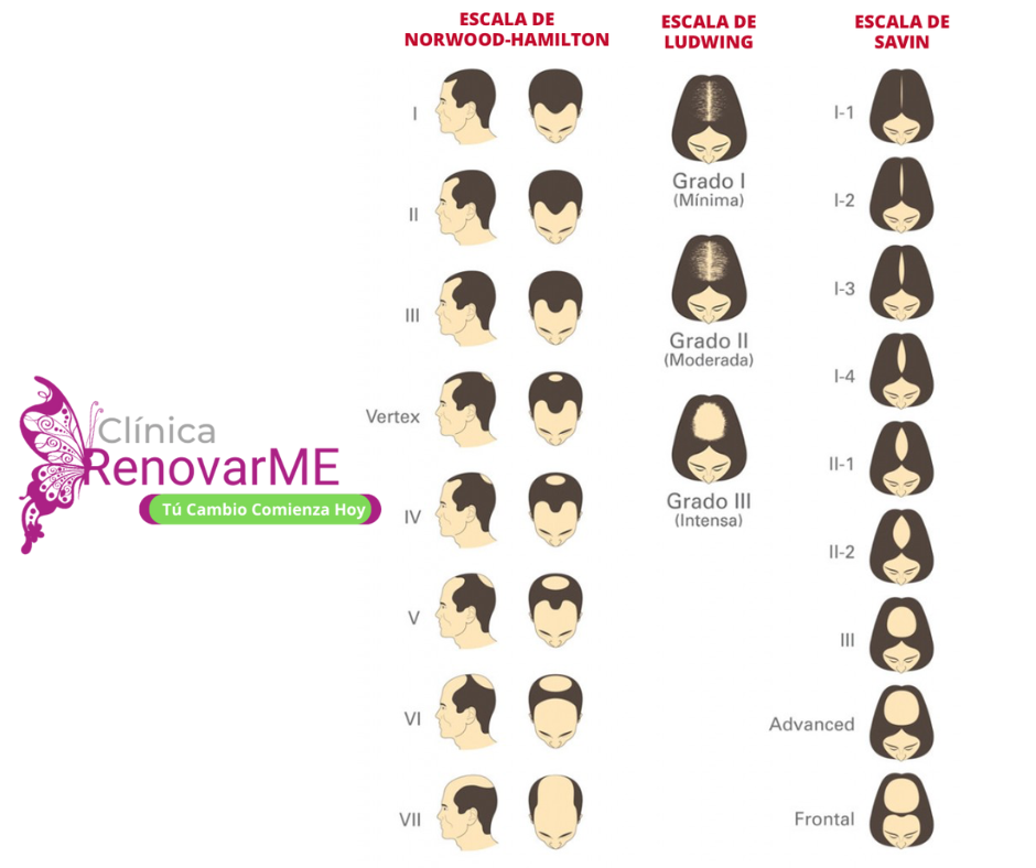 Caída del Cabello - Clinica RenovarMe